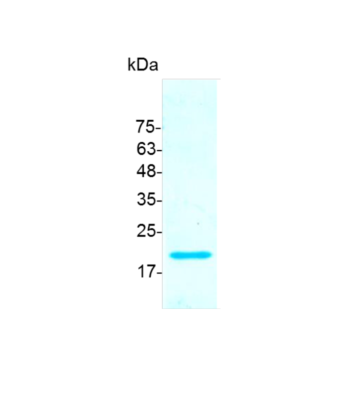 TNF beta (Tumor necrosis factor-β), Human | Taiwantrade.com