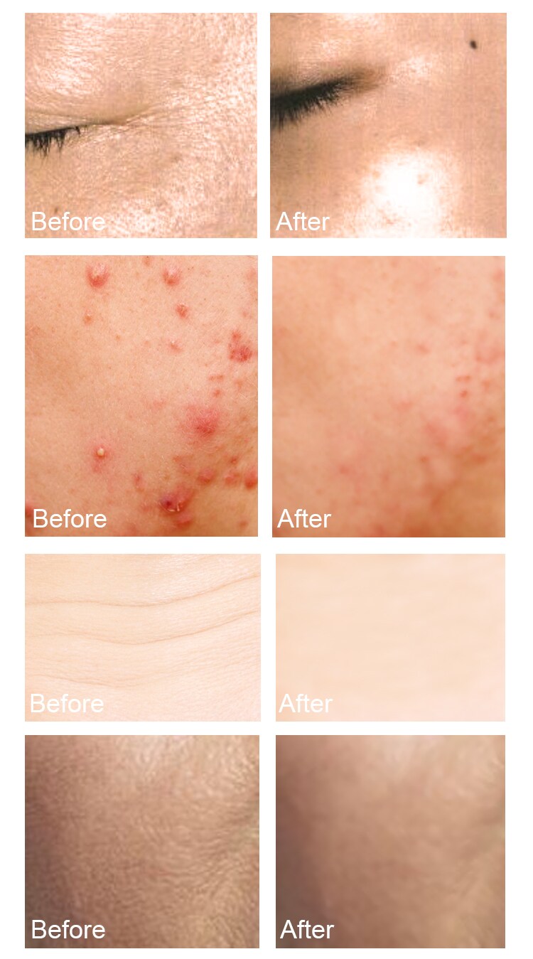 taiwan skincare serum oem Private Label/protection Moisturizing Anti ...