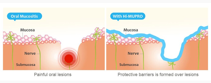HI-MUPRO Oral Gel (Spray) | HANNOX INTERNATIONAL CORP.